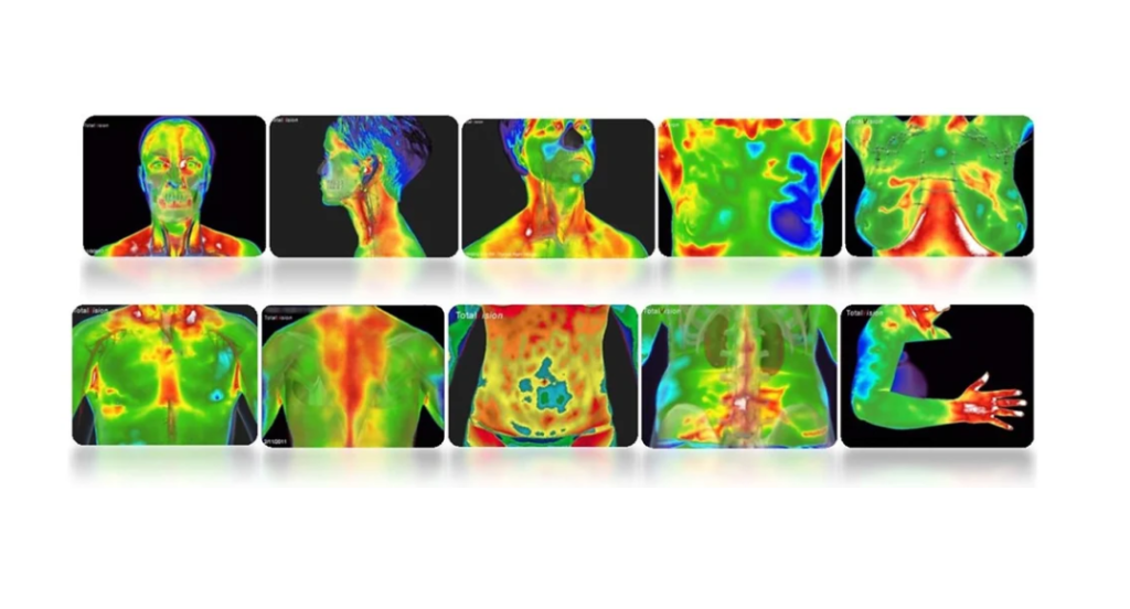 Rebalance Plus Thermography Body Thermal Imaging in Pembroke Pines ...